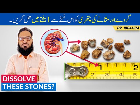 Gurde Aur Masane Ki Pathri Ka Ilaj | Dissolve Kidney & Bladder Stones in 1 Week | Urdu/Hindi