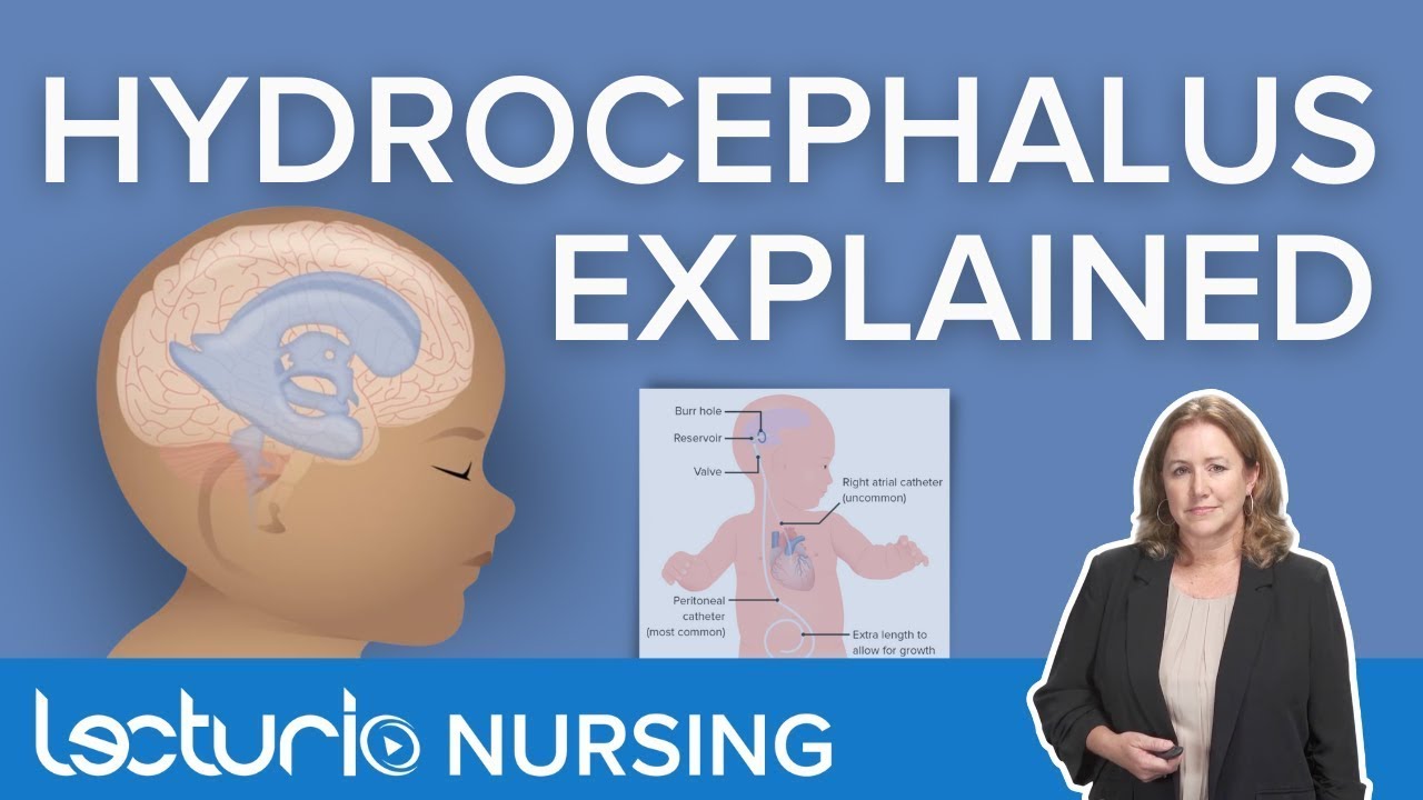 Pediatric Hydrocephalus: Causes, Signs & Treatments Explained 🧠