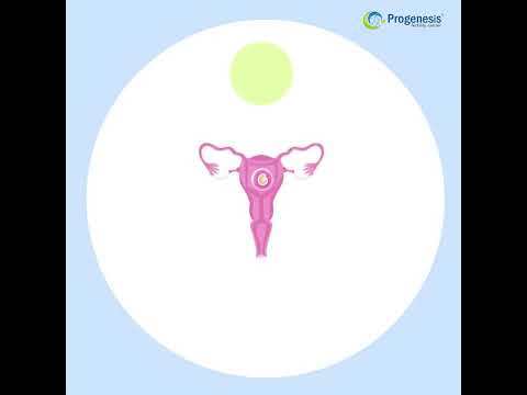 IVF Process Step-by-step animation.
