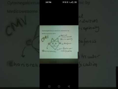 cytomegalovirus mnemonic