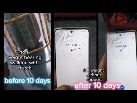 post rehab| home visit| 10days best result|Sara's clinic,Madurai.Ph 7200883554