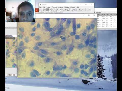 Morphology analysis using Image J
