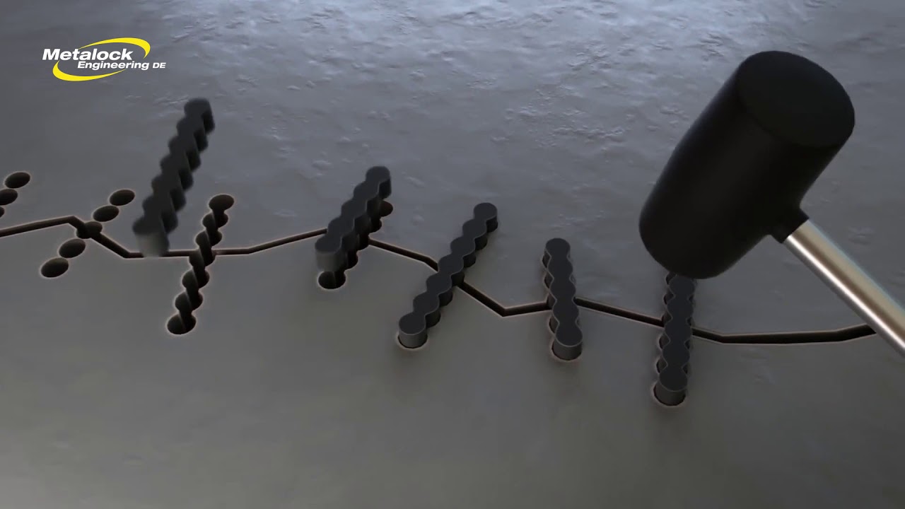 Metalock Procedure / Metal Stitching