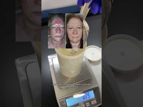 If you have rosacea you need to know about this ingredient