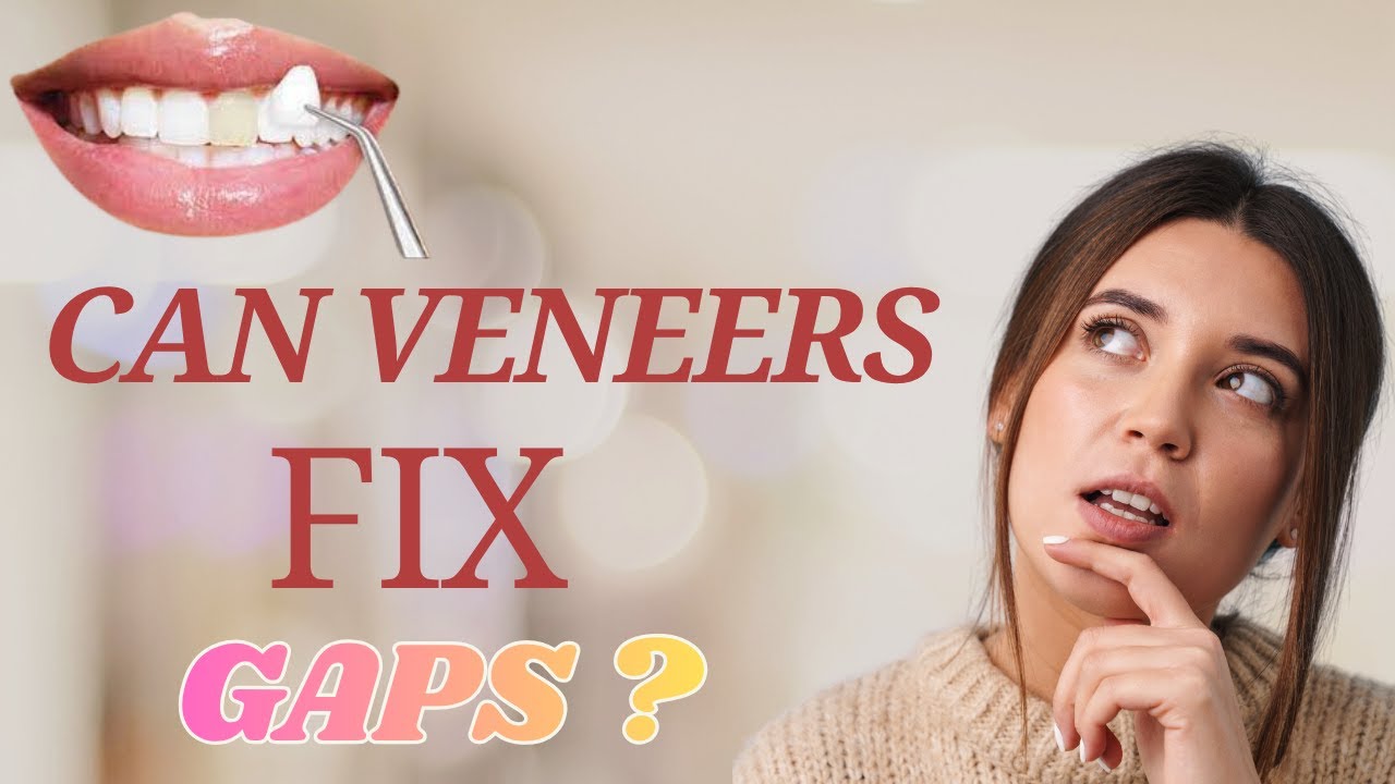 Can Veneers Fix Gaps in Teeth? | Cosmetic Dentistry Explained