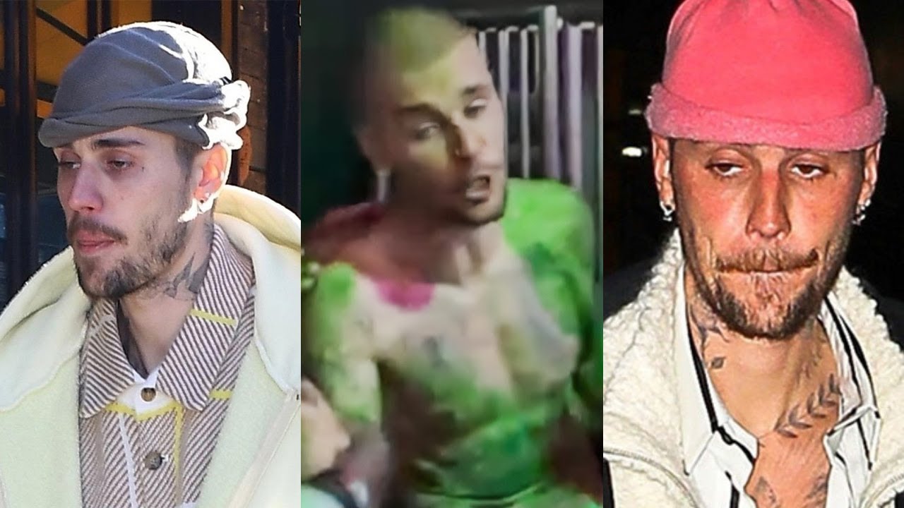 Every Single Justin Bieber Meltdown of 2025: What REALLY Happened? 😰