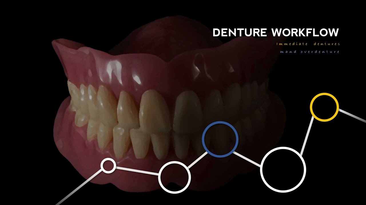Immediate Denture and Overdenture Workflow