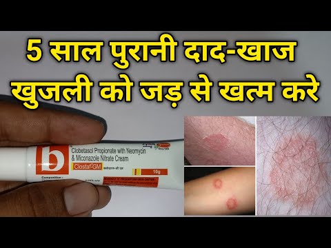 Betnovate GM - Betnovate GM Cream Latest Price, Dealers & Retailers in ...