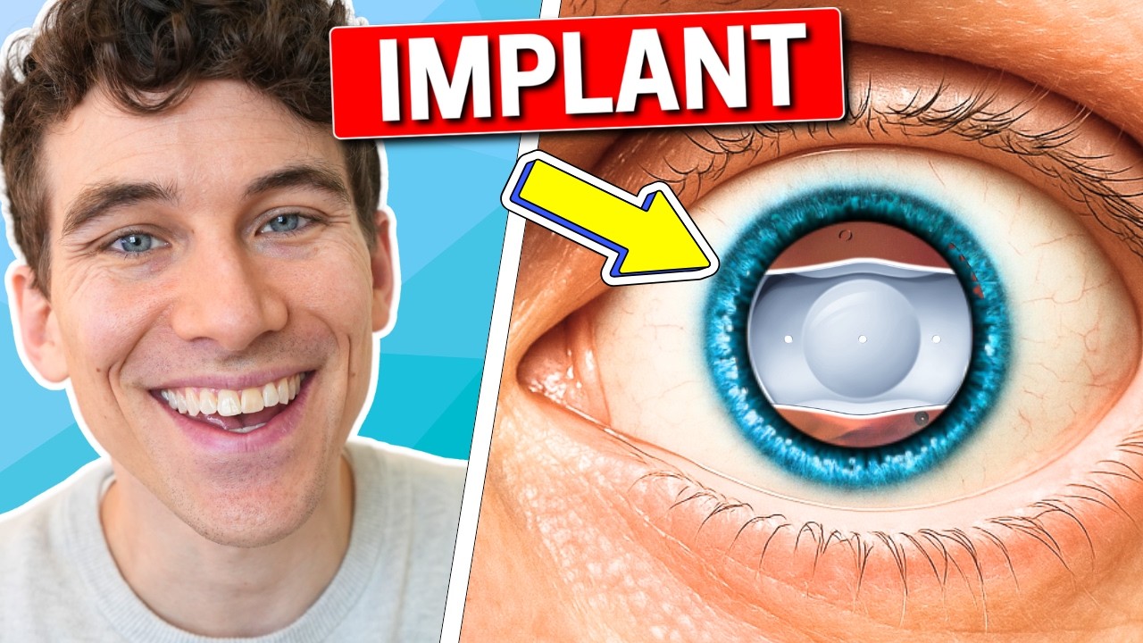 I got EVO ICL Eye Surgery - Here's What Happened
