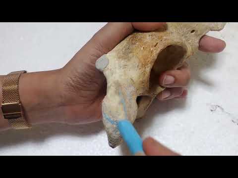 Ischial tuberosity of hip bone