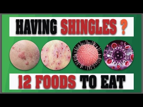 Top 12 FOODS to eat if you have SHINGLES