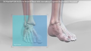 Patient Education in Orthopedic Surgery – OrthoPedia Patient