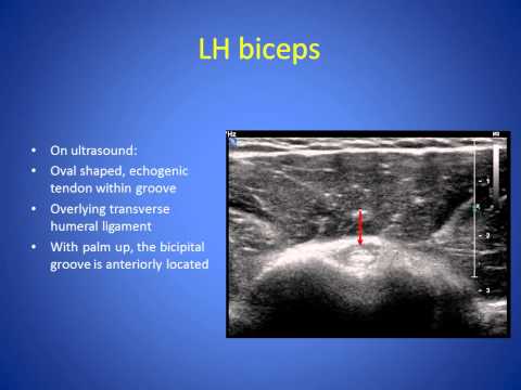 US Guided Shoulder Interventions - Campbell.mp4