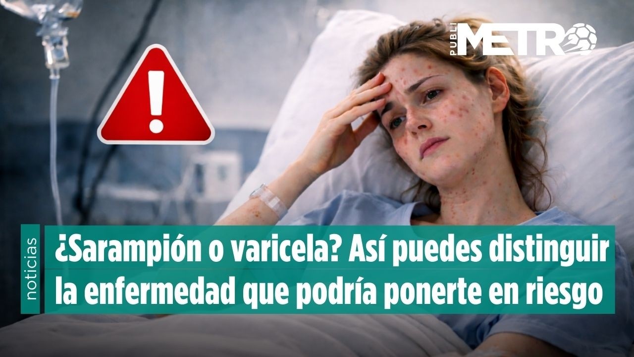 Measles or chickenpox? Here's how to tell the difference between the two diseases that could put ...