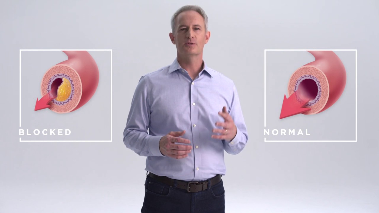 What happens at a Life Line Screening appointment