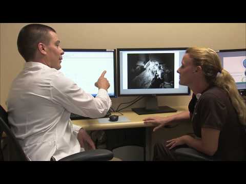 SSM Epilepsy Monitoring Unit