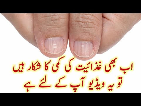 How to Treat Nutrient Deficiency in Urdu | Nutrients Definition Treatment