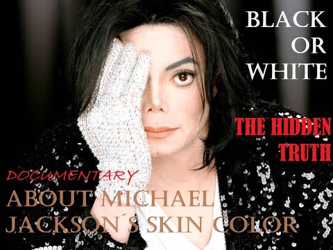 WHY MICHAEL JACKSON TURNED WHITE - BLACK OR WHITE SKIN COLOUR (DOCUMENTARY)