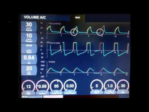 Principles of Mechanical Ventilation - Part 1