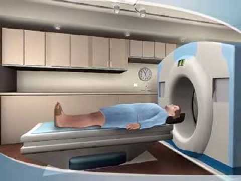 What to expect during a Myelogram at CDI
