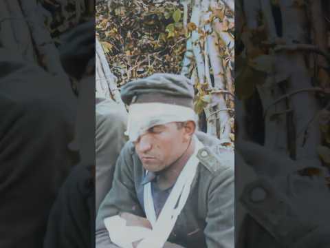 Wounded German POWs in 1918 - Restored Footage