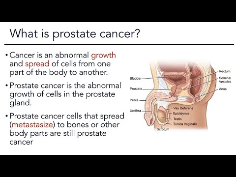 Prostate Cancer Overview