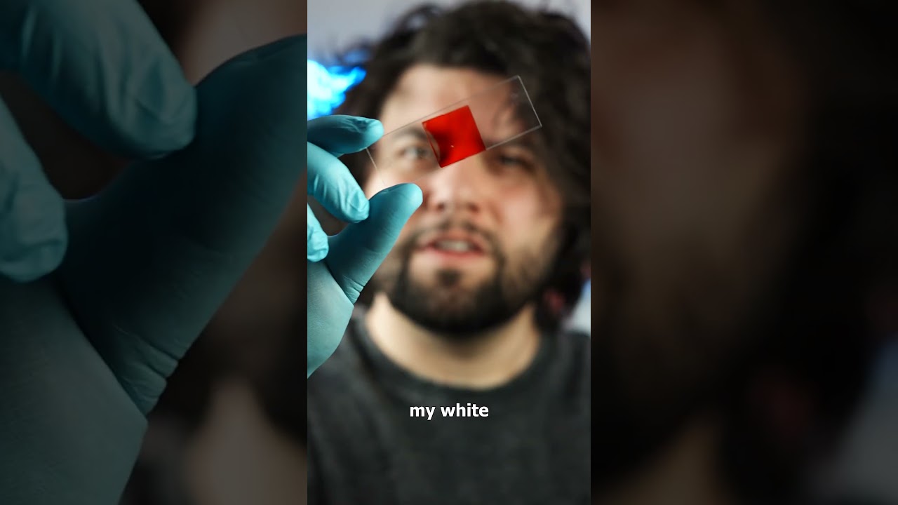 White Blood Cell VS Still Water Microbes!