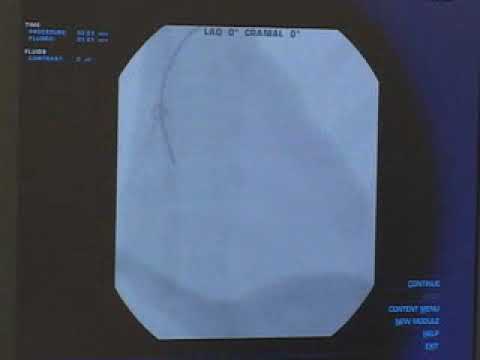 Medical Education: Medtronic System