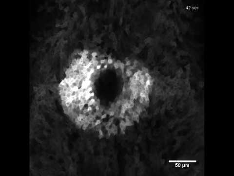 Calcium is unregulated in epithelial cells around a laser wound in the Drosophila pupal notum