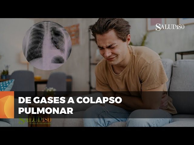 Silvia Pinal sufre colapso pulmonar, ¿qué tan grave es?
