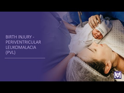 PVL (Periventricular Leukomalacia)