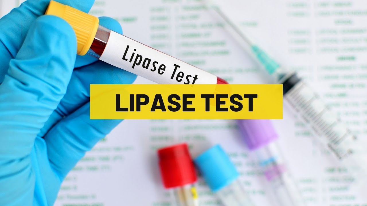 Lipase Test | My Lab Solution