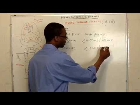 Acute tubular necrosis lecture