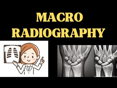 macro radiography | magnification radiography | direct magnification radiography| uses, application