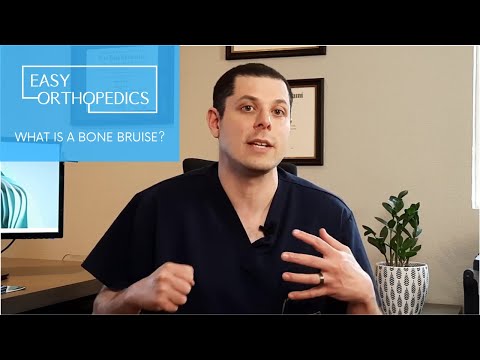 What is a bone bruise?
