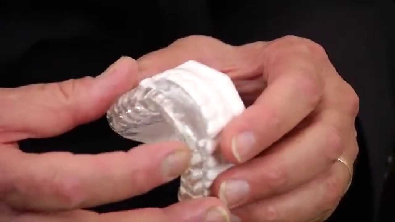 Prosthodontists and TMJ Treatment - Clary & Fueredi Prosthodontics & General Dentistry
