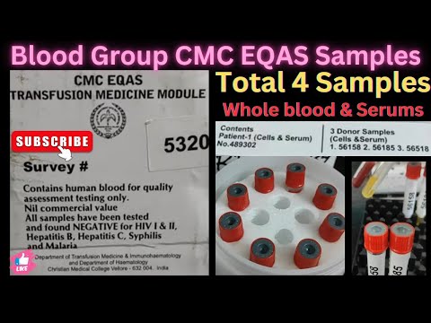 Blood Group CMC EQAS Samples | Whole blood & Serums | @medicallabtechnologysajal6903