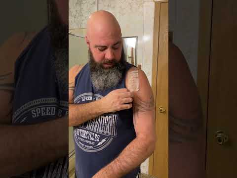 Full Shoulder Replacement Scar Reveal