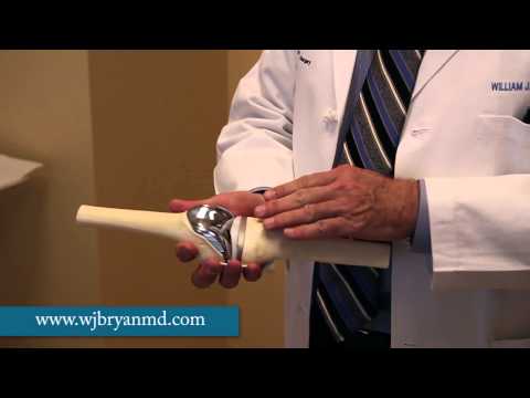 What kind of hardware is used for a total knee replacement?