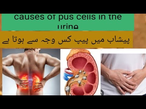 causes of pus cells in the urine