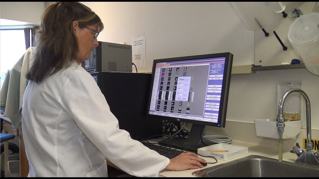 Circulating Tumour Cells (CTCs): Tracking the Spread of Cancer