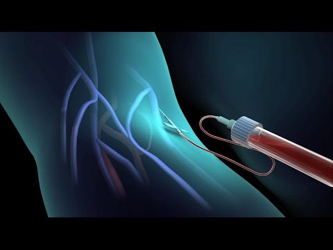 Blood Test for Cholesterol | Nucleus Health