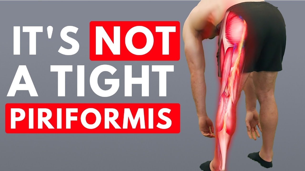 Sciatica Isn’t What You Think – Here’s the REAL Fix