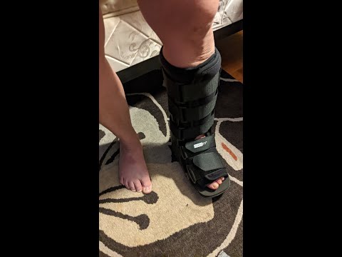 Posterior Tibial Tendon Dysfunction Surgery