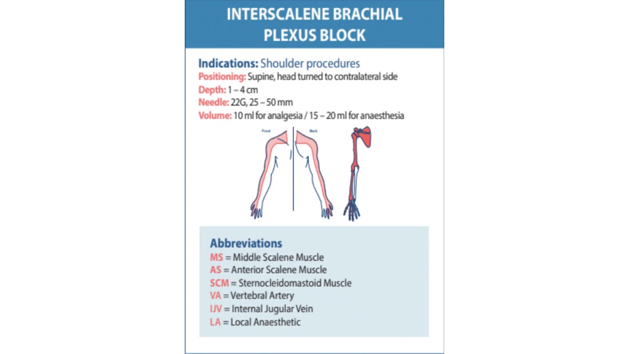 Interscalene Block for Shoulder Surgery #Anaesthesia