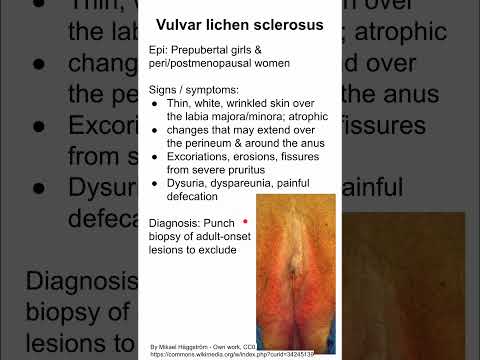 Vulvar lichen sclerosus