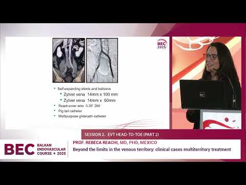 BEC 2025 | Beyond the limits in the venous territory: clinical cases multiterritory treatment