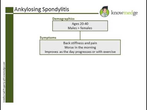 Internal Medicine ABIM Board Exam Review Question: Ankylosing Spondylitis