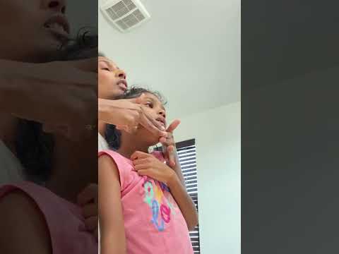 Oral motor massages.!! #autism #speechdelay #autismintelugu