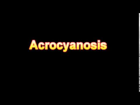 what is the definition of Acrocyanosis (Medical Dictionary Online)